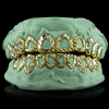 GOLD GRILLZ - Atlanta Custom Gold Grillz