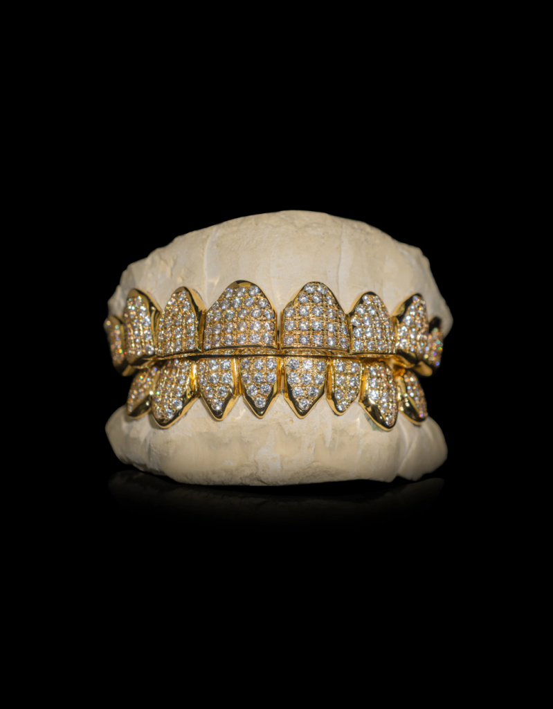 SOLID GOLD FULLY BUSTDOWN ICED GRILLZ (SI CLARITY DIAMONDS)