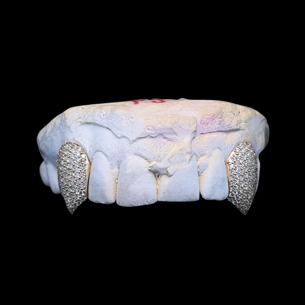 Atlanta Custom Gold Grillz - #1 Grillz in Atlanta